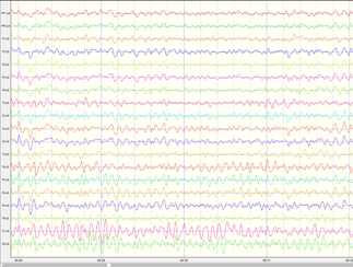 Tilgang - Imaging Future