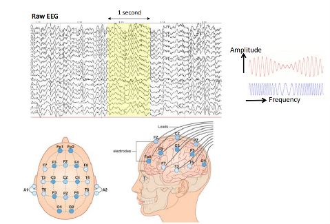 Hvad er EEG? - Imaging Future